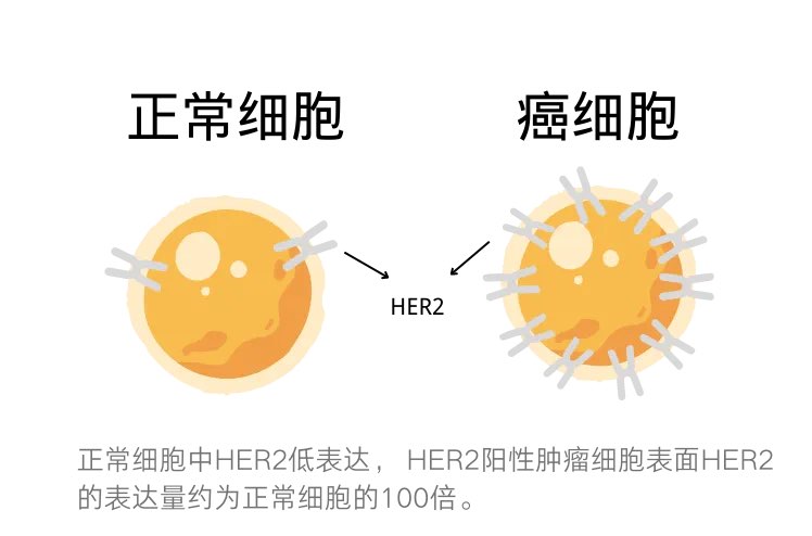神奇的抗HER2治疗-春雨医生